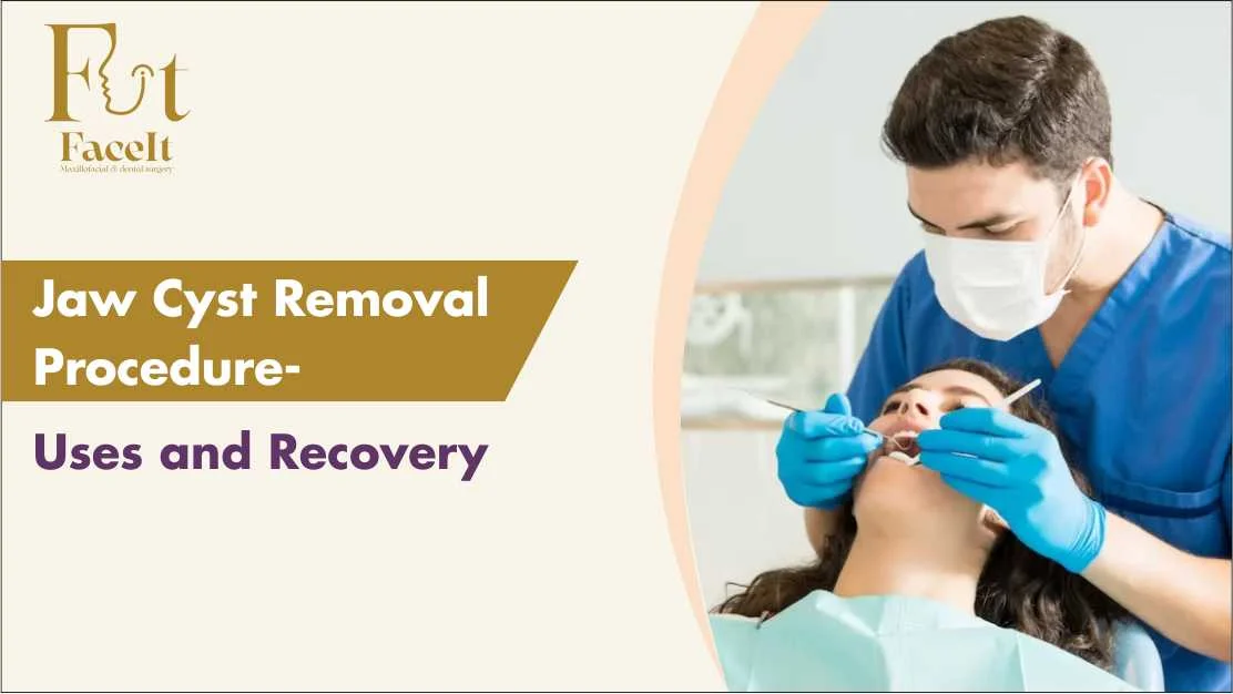 Jaw Cyst Removal Procedure - Uses & Recovery